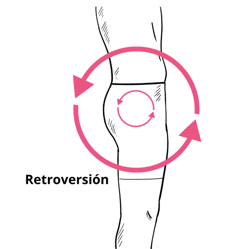 Diferencia entre Anteversión y Retroversión de la pelvis