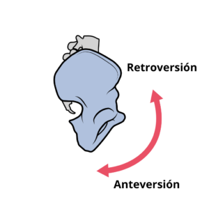 Diferencia entre Anteversión y Retroversión de la pelvis