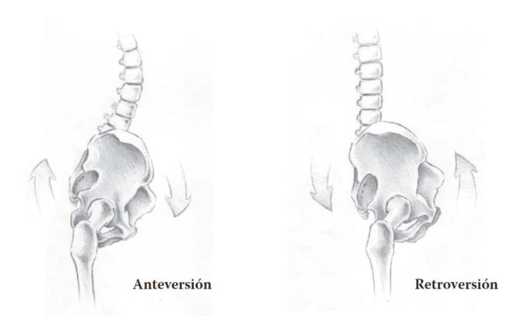 Diferencia entre Anteversión y Retroversión de la pelvis
